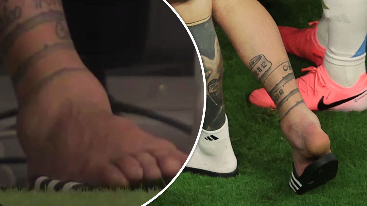 Así quedó el tobillo de Messi tras salir de la final de la Copa América ...